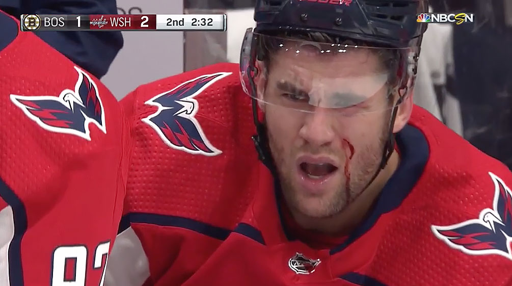 Tom Wilson bleeds his own blood