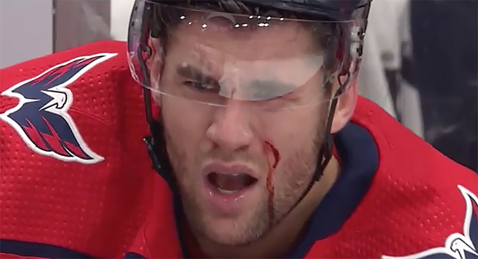 Tom Wilson bleeds his own blood