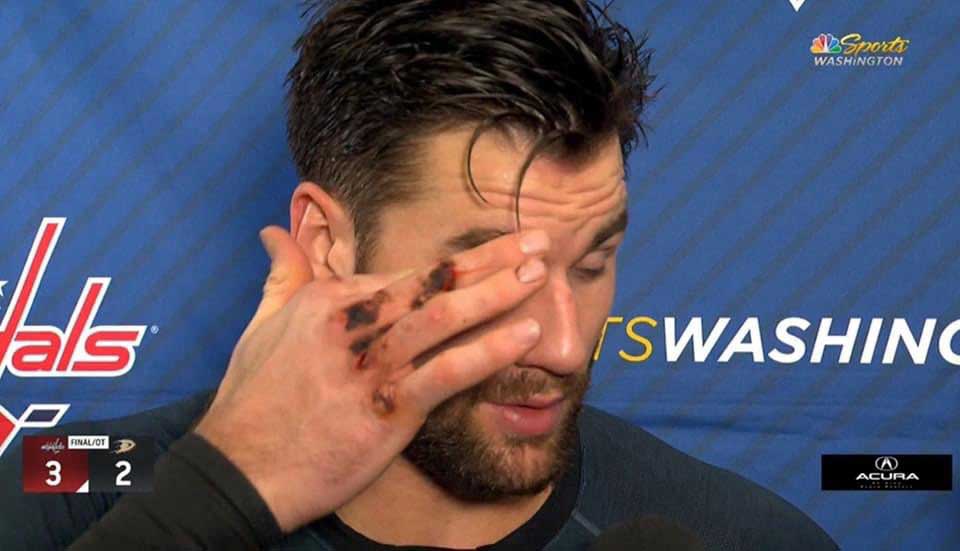 Tom Wilson wins game in overtime after grotesquely bloodying knuckles ...