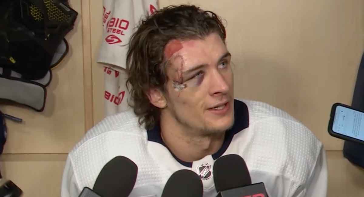 Chandler Stephenson helped Morgan Barron after skate blade to face ...